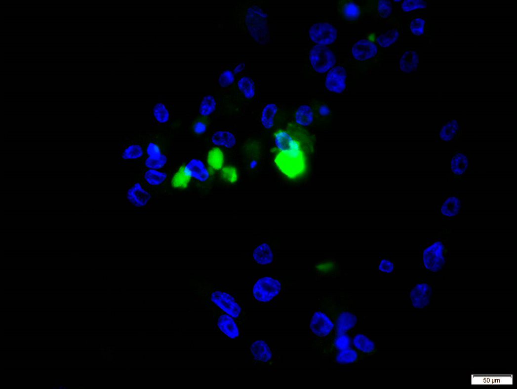 Hepatitis E Platform - Optimizing HEV cell culture